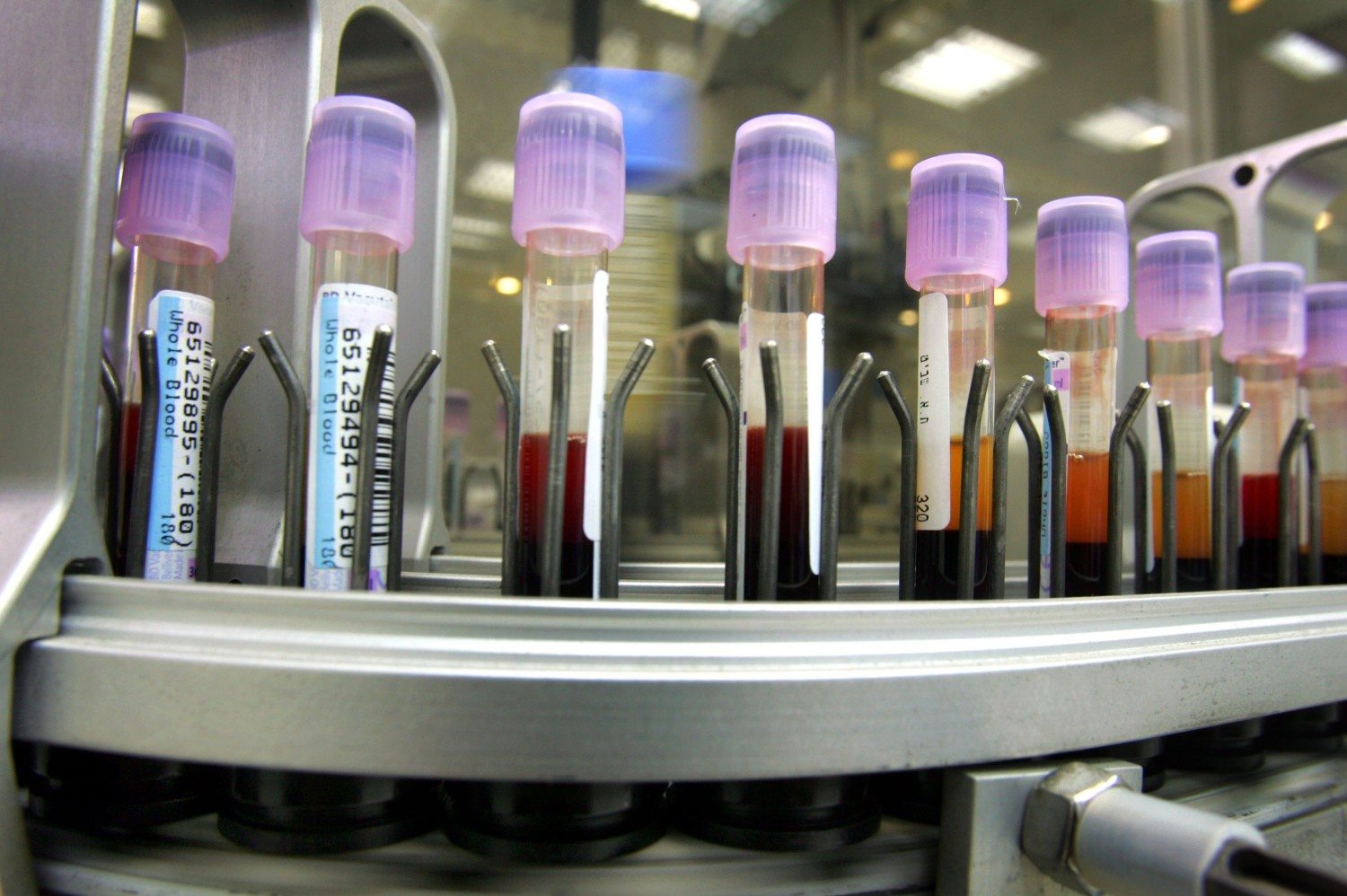 Government set to overhaul blood donation rules for men who have sex ...