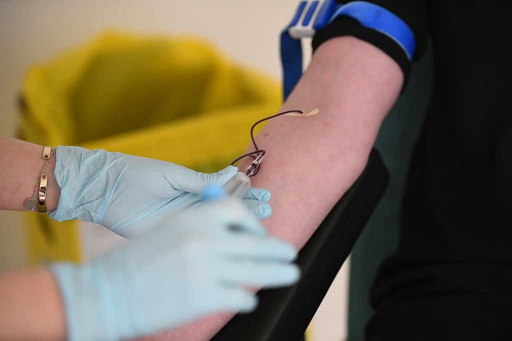 What is a vampire facial? The beauty treatment linked to HIV infection ...