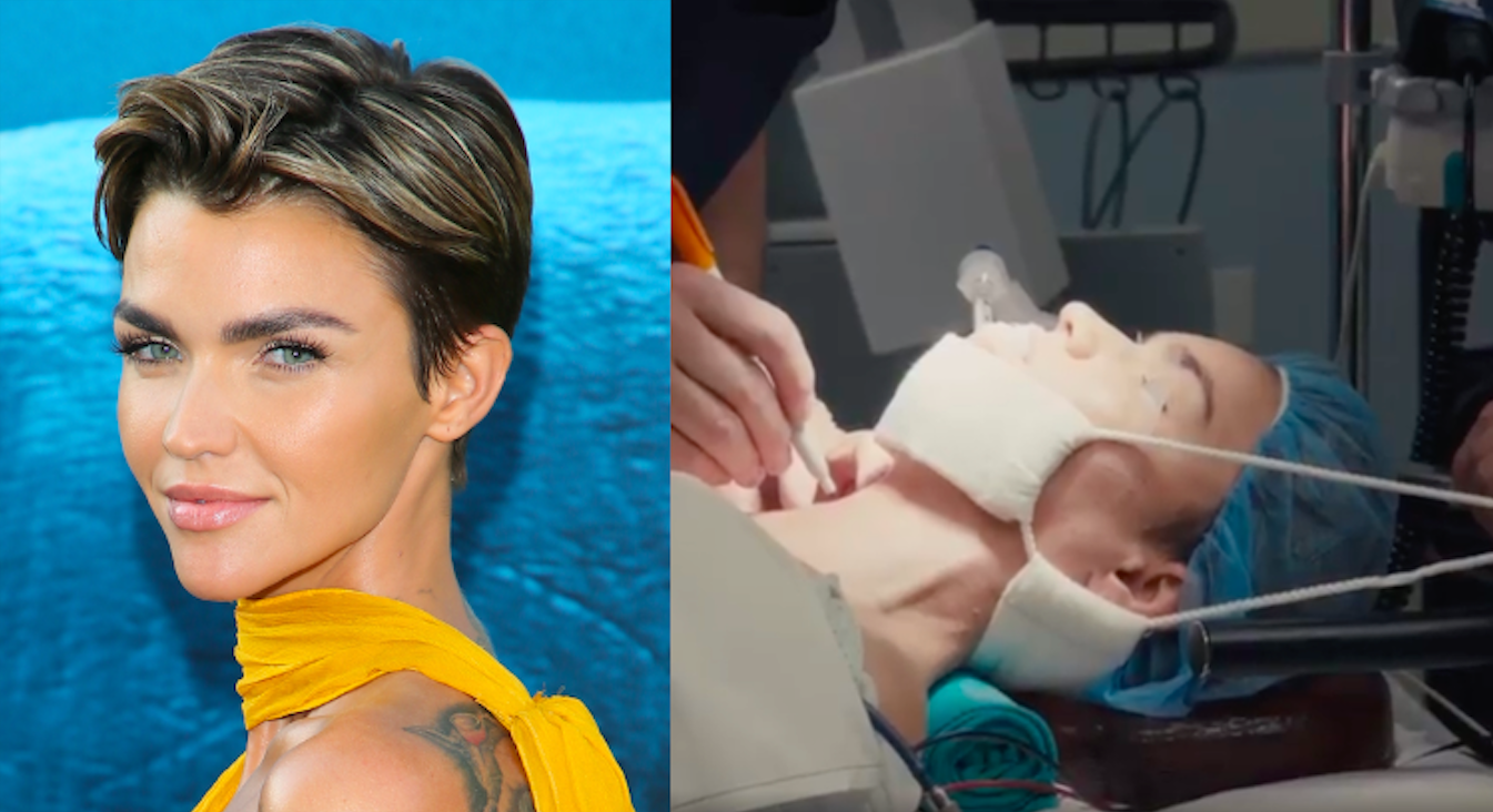 Ruby Rose undergoes emergency surgery after stunt accident nearly left ...