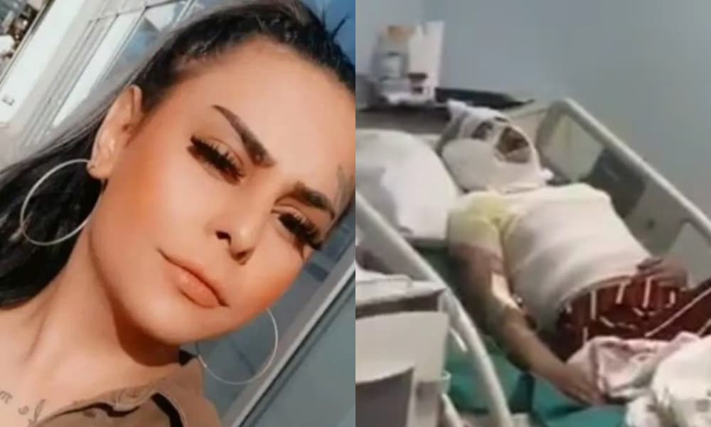 Trans acid attack victim raises thousands for reconstructive surgery