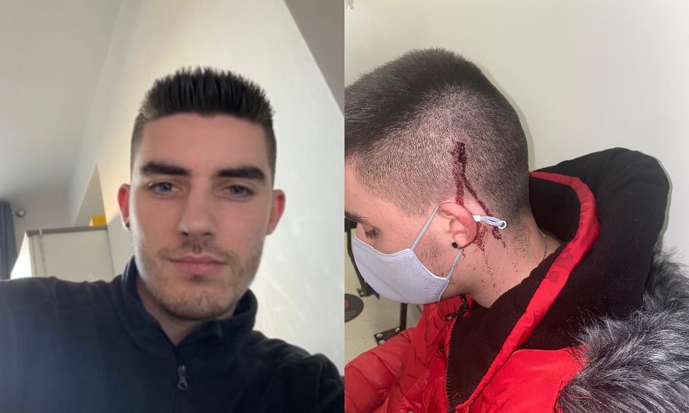 Student battered in 'homophobic attack' outside London gay club