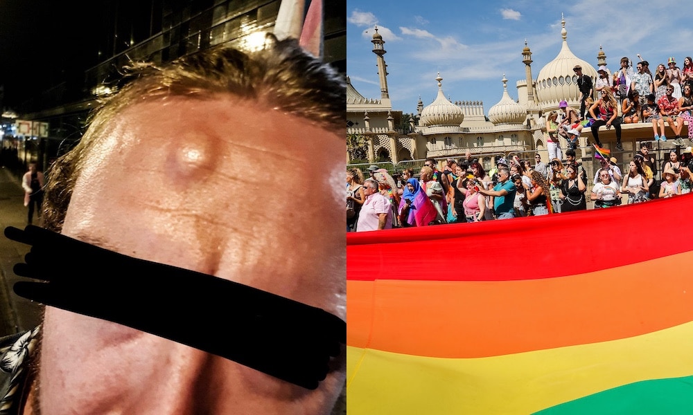 Non-binary person injured by 'toilet-policing' pub worker at Pride