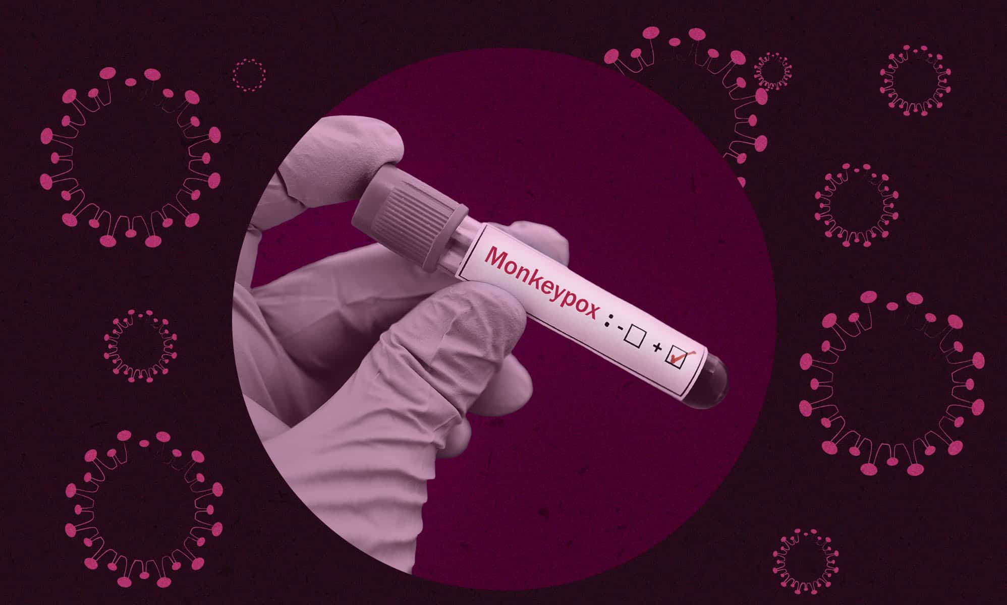 First monkeypox deaths since global outbreak began confirmed