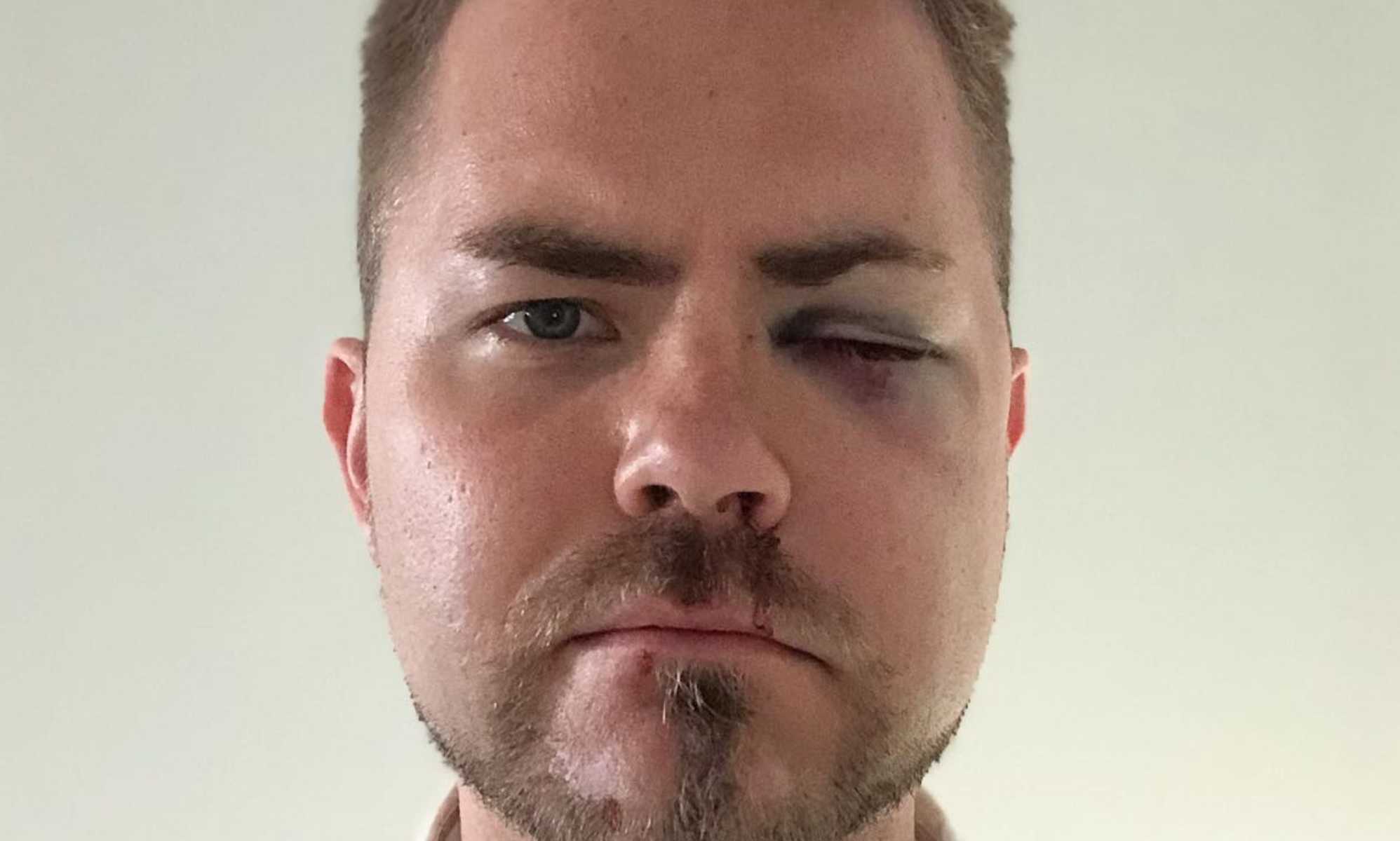 Baltic Knife attack victim recalls 'pain and confusion' of incident