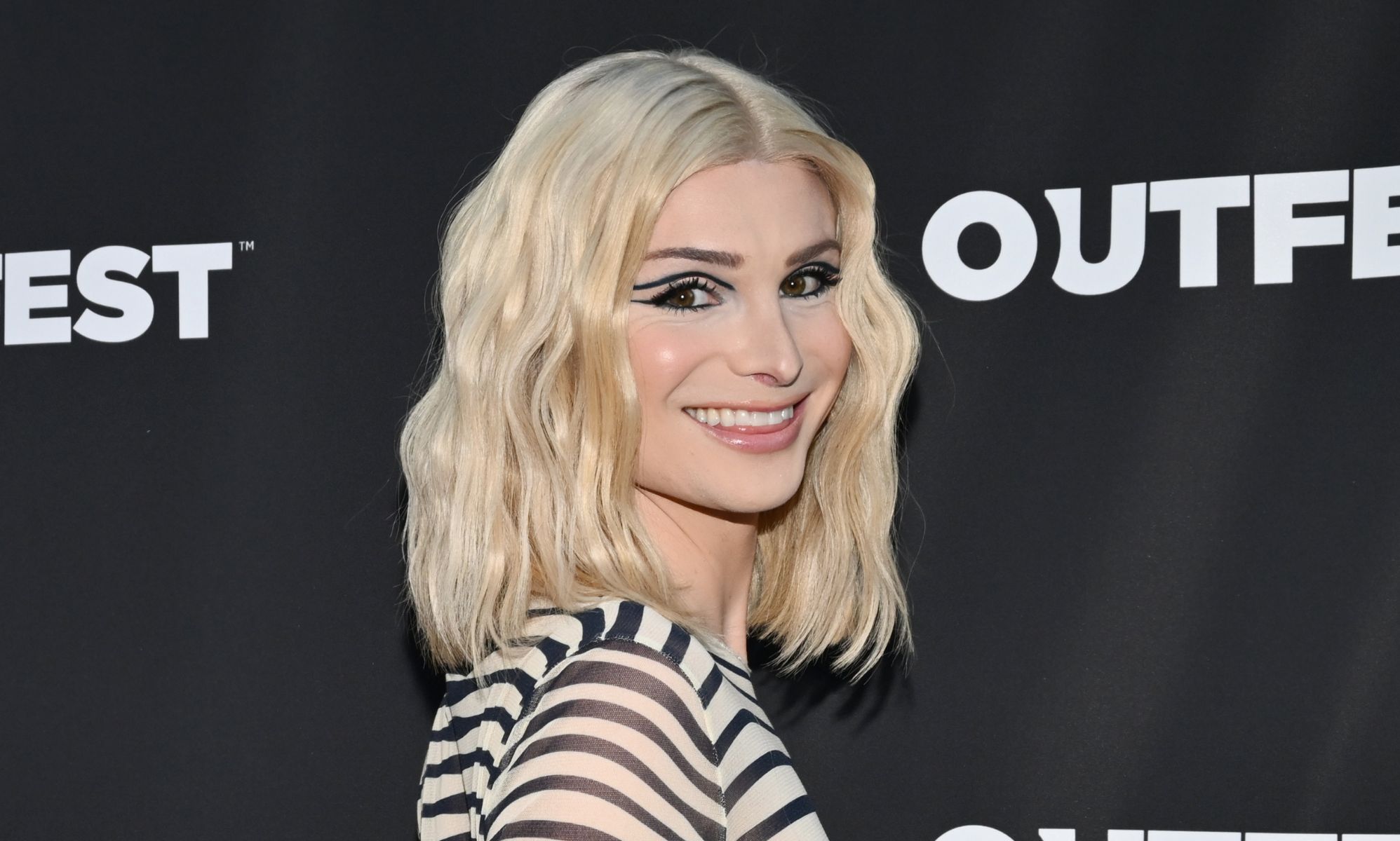 Dylan Mulvaney opens up about facial feminisation surgery