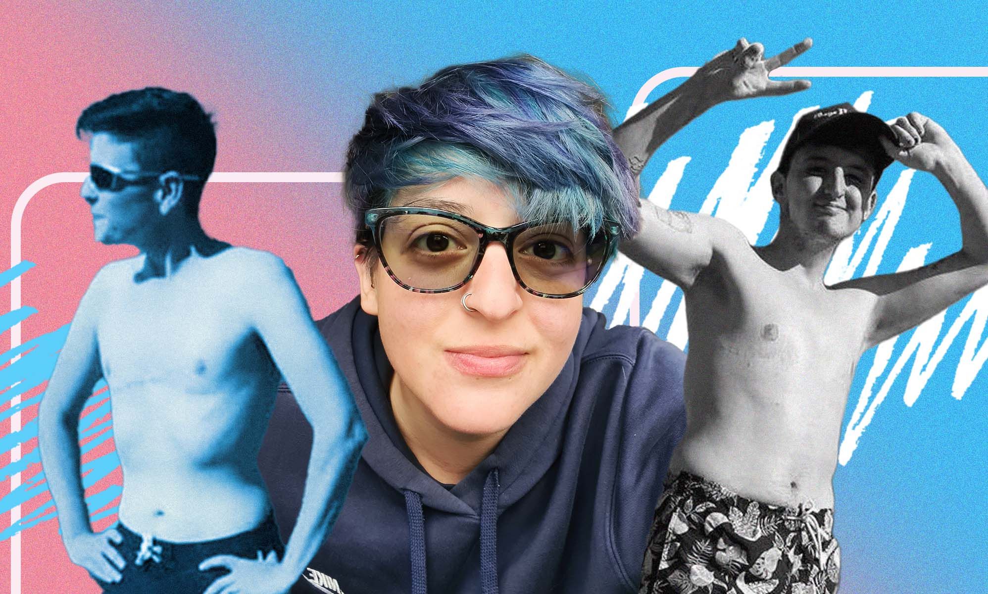Trans and non-binary folks on the joy of having top surgery