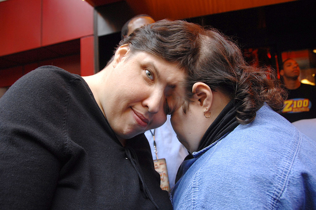 The true, inspiring story of conjoined twins Joy and Joyce Magsino