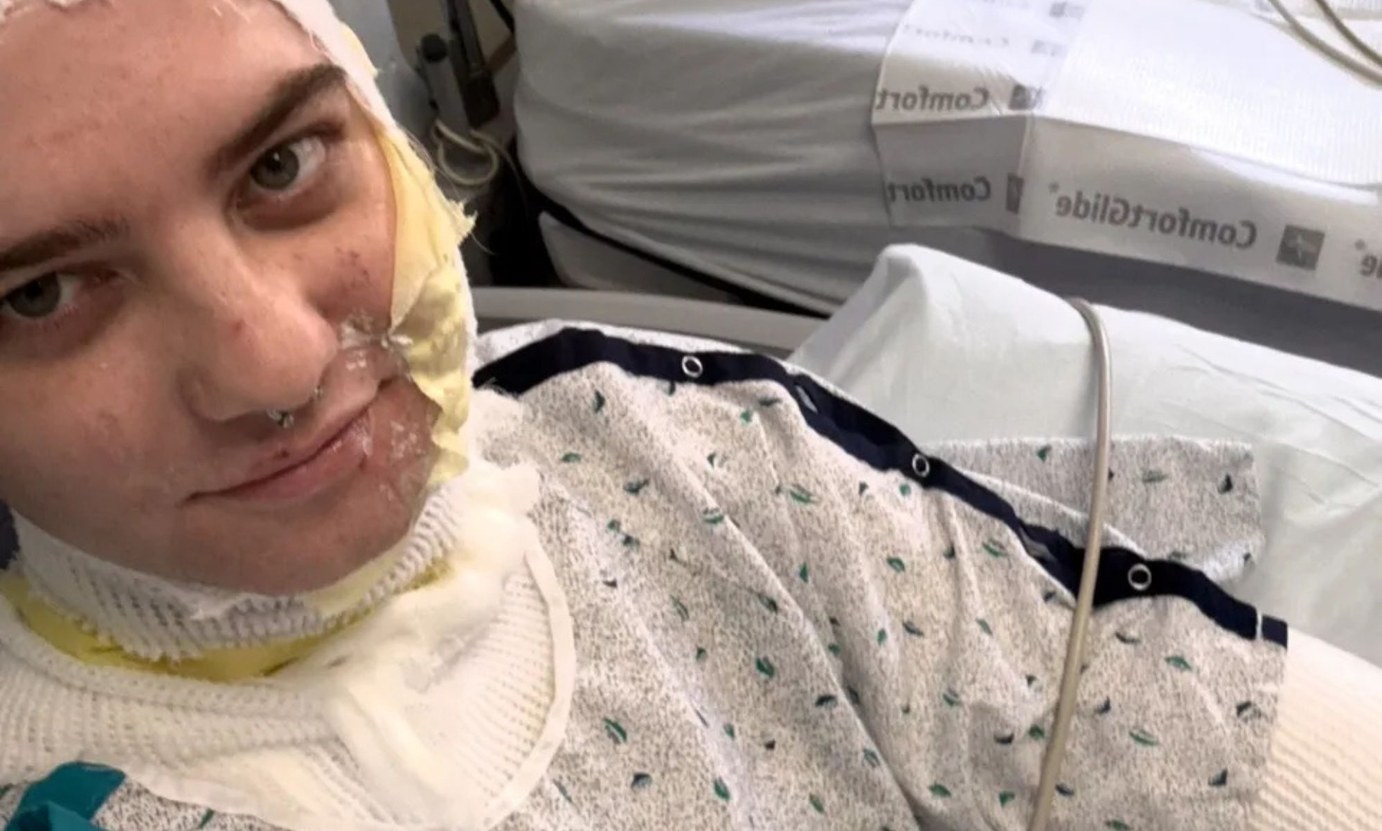 Trans acid attack victim raises thousands for reconstructive surgery