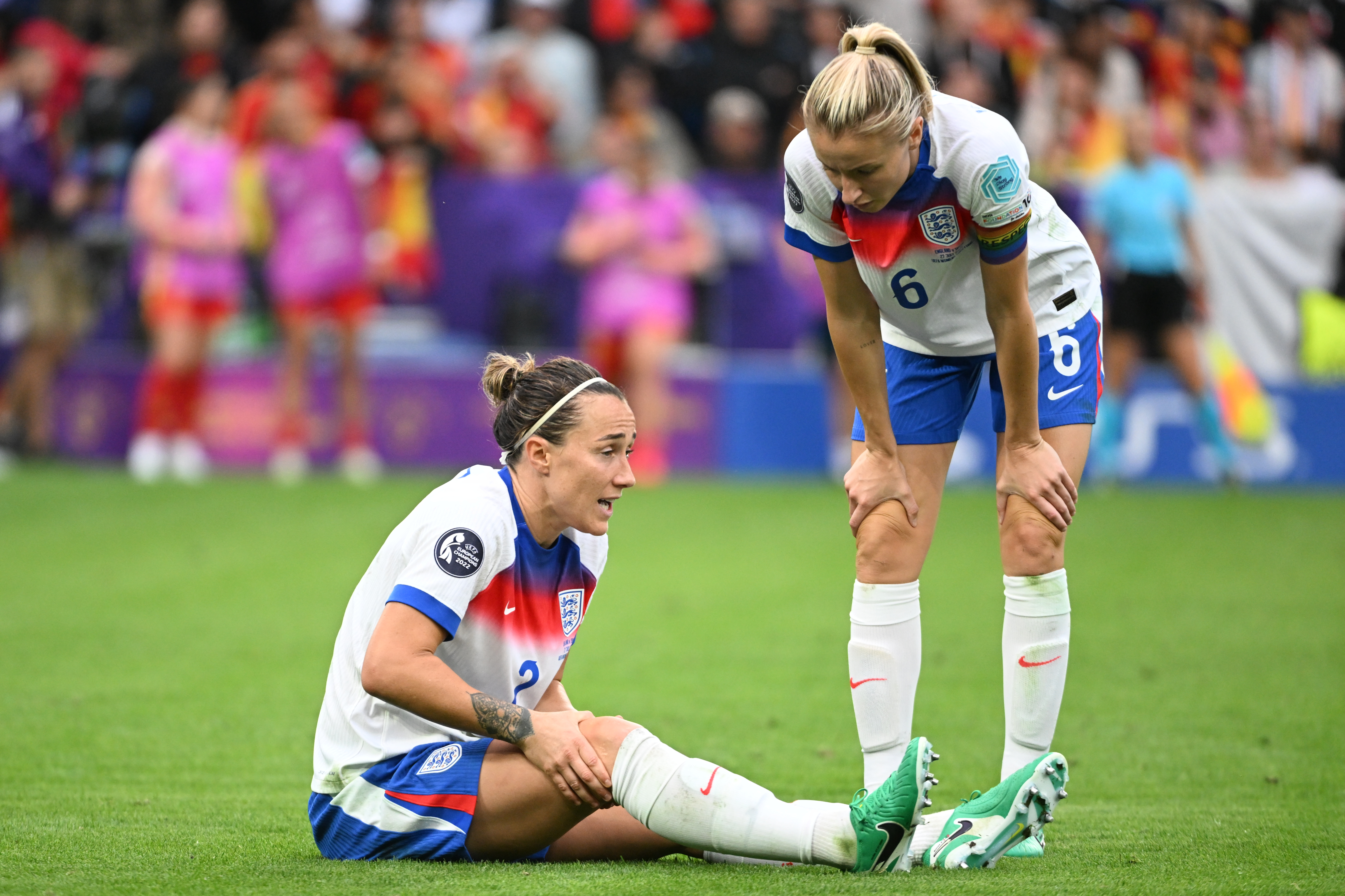 This England Lioness played the Euro 2025 with a broken leg